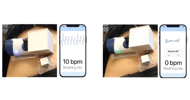 West Partners with University of Washington to Develop a Wearable Injector